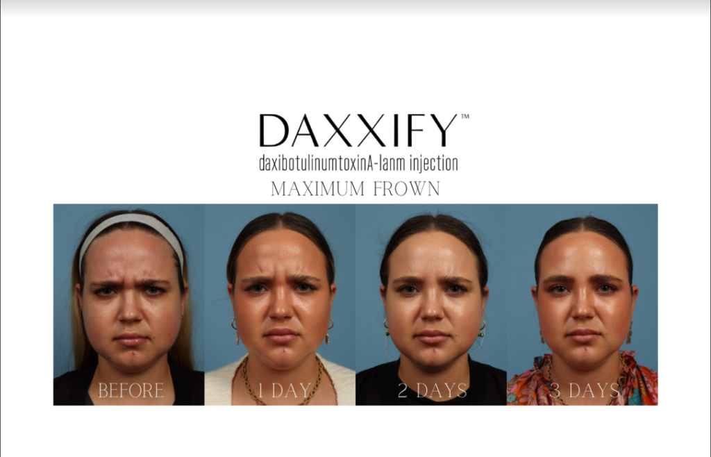 Daxxify - 50 Units | Asia Pacific Plastic Surgery
